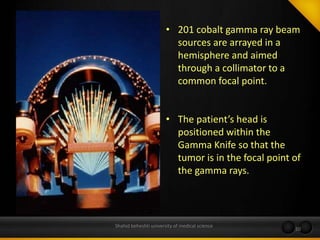 Gamma knife radiosurgery | PPT