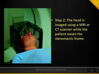 Gamma knife radiosurgery | PPT