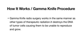 GAMMA KNIFE.pdf
