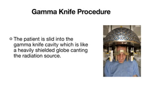 GAMMA KNIFE.pdf