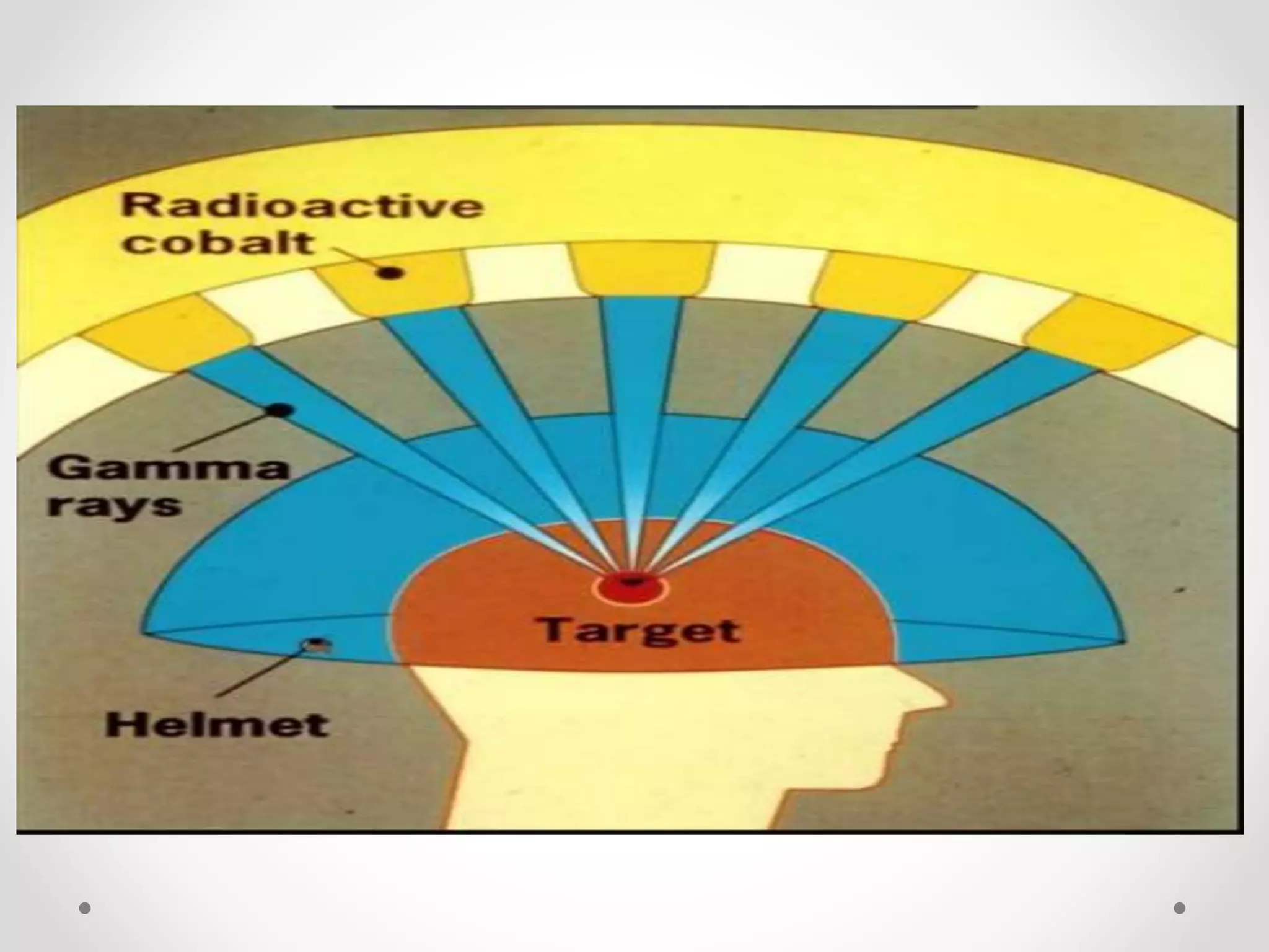 GAMMA KNIFE , X-KNIFE AND CYBERKNIFE | PPTX