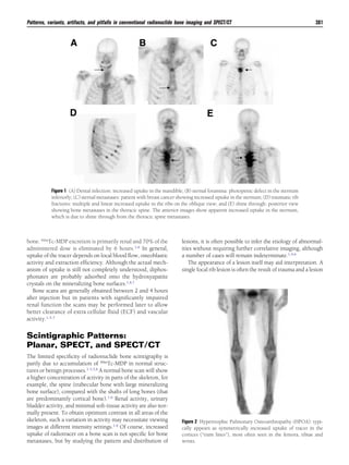 Gamma osea variantes (2) | PDF