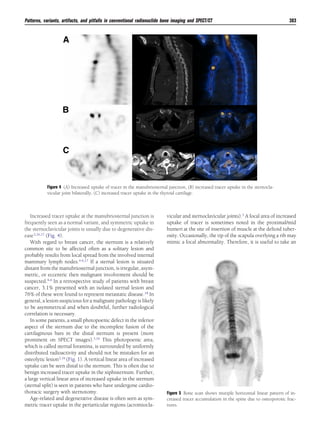 Gamma osea variantes (2) | PDF