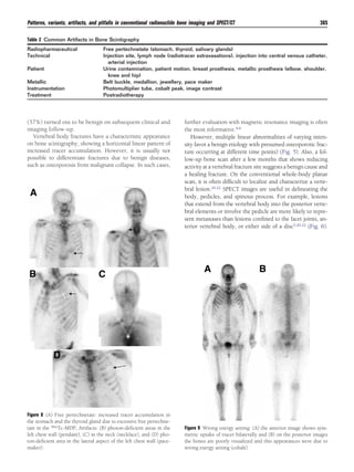 Gamma osea variantes (2) | PDF