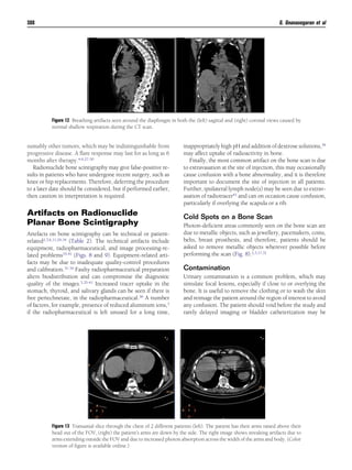 Gamma osea variantes (2) | PDF