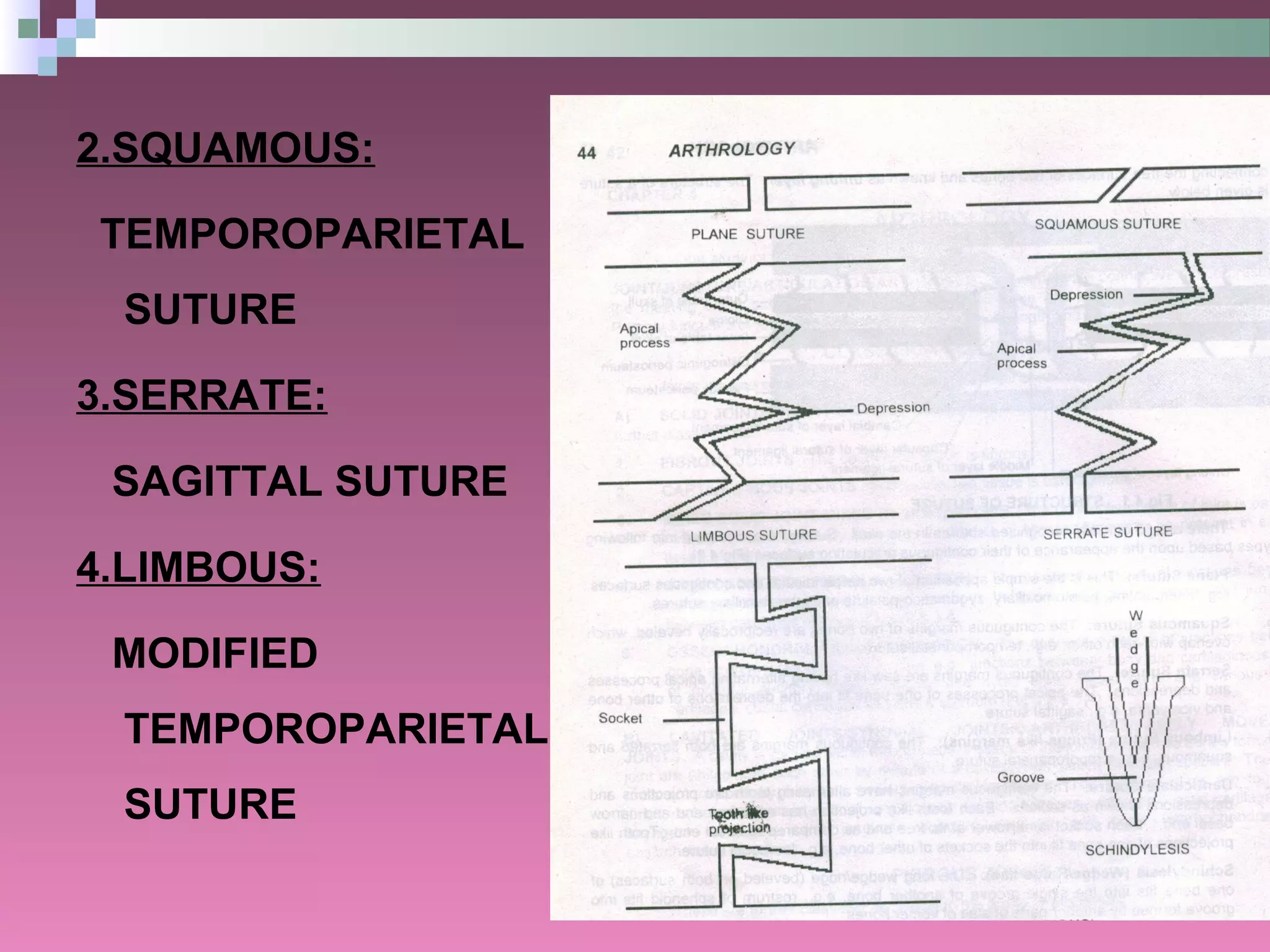 General Anatomy of Joints | PPT