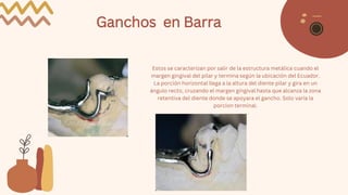 Ganchos de barra circunferenciales y tipo barra o acción de punta (2).pptx