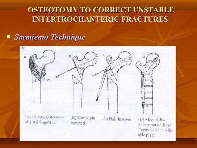 osteotomies around hip by dr gandhi