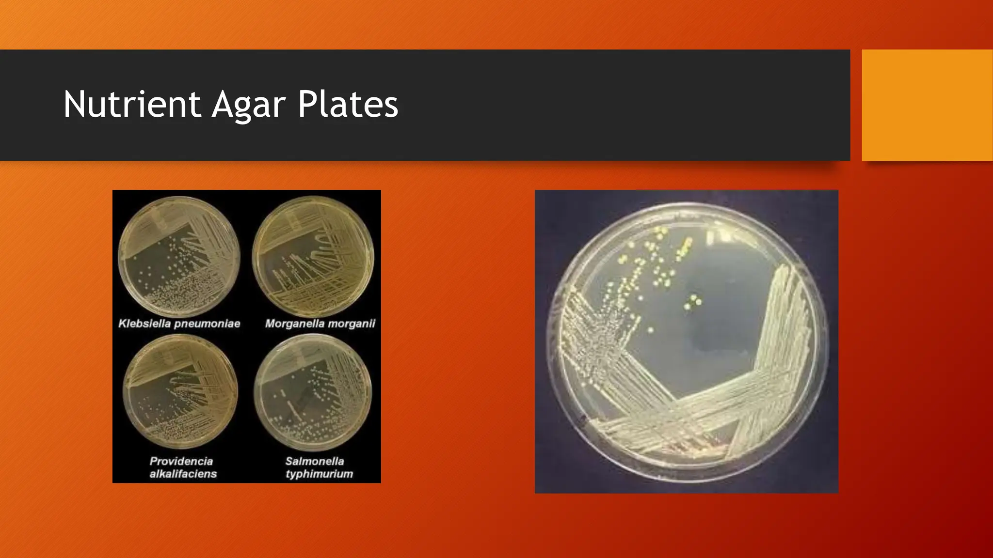 Bacteria 🦠 culture media Types of culture media Nutrient agar Identification media | PPTX