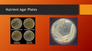 Bacteria 🦠 culture media Types of culture media Nutrient agar ...