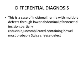 Abdominal hernia.pptx