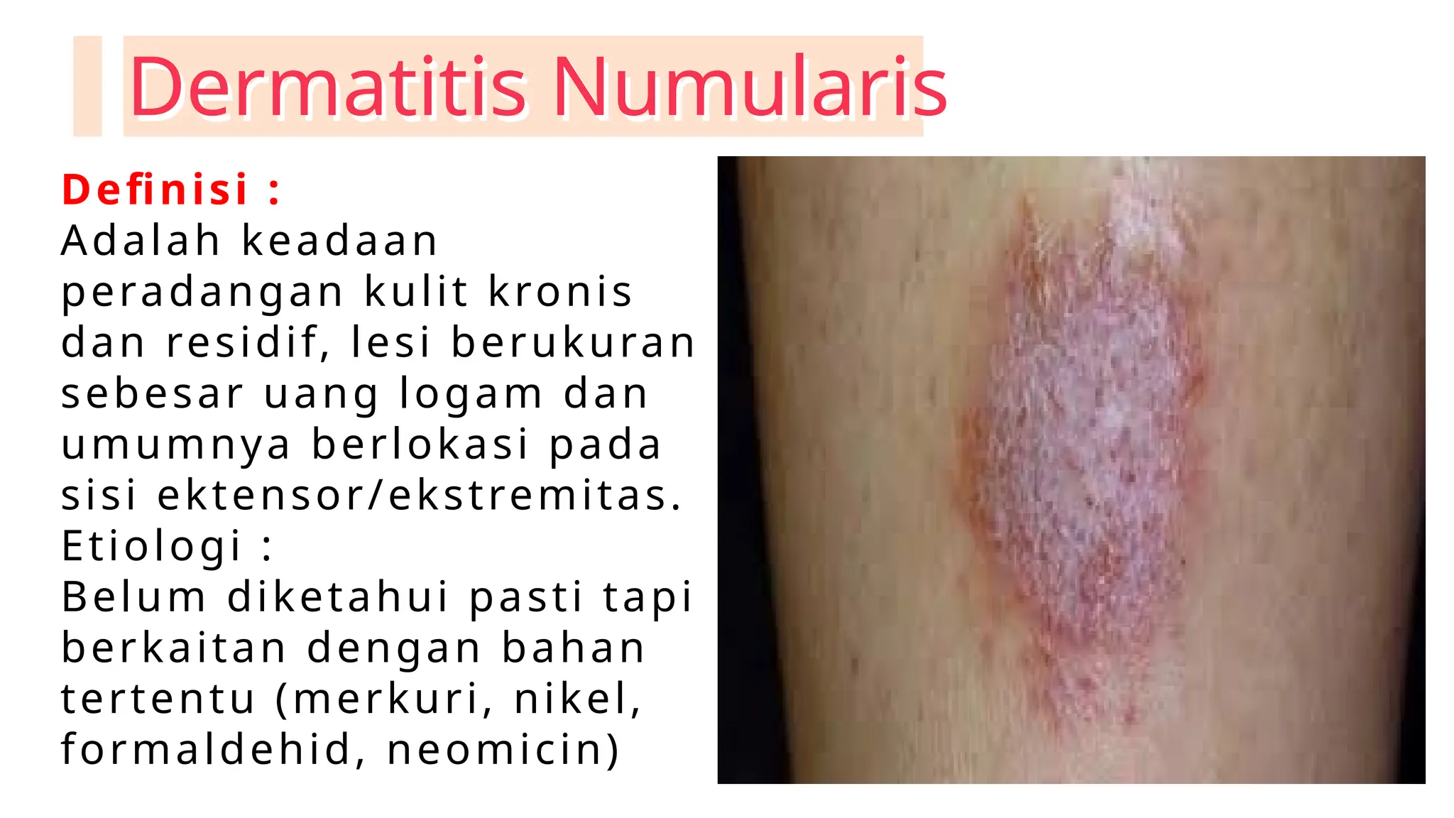 Gangguan Kulit INTEGUMEN kelas xii smk kesehatan.pptx