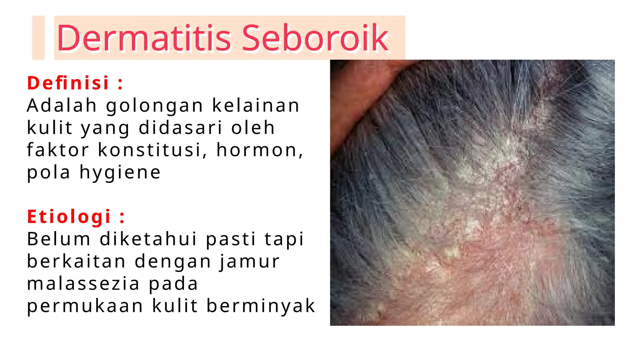 Gangguan Kulit INTEGUMEN kelas xii smk kesehatan.pptx