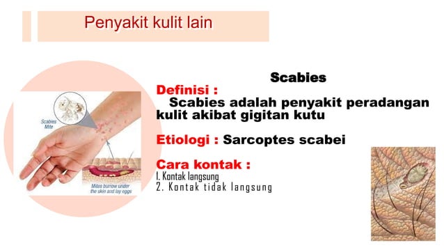 Gangguan Kulit INTEGUMEN kelas xii smk kesehatan.pptx