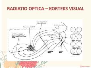 Gangguan lapang pandang by Gabriella | PPT