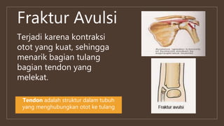 Gangguan pada sistem gerak. | PPTX