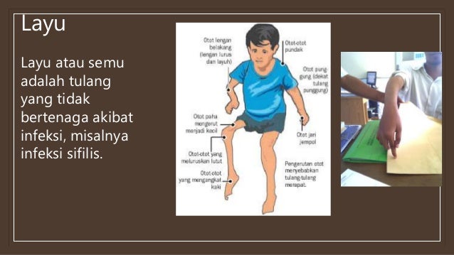 Gangguan pada sistem gerak.