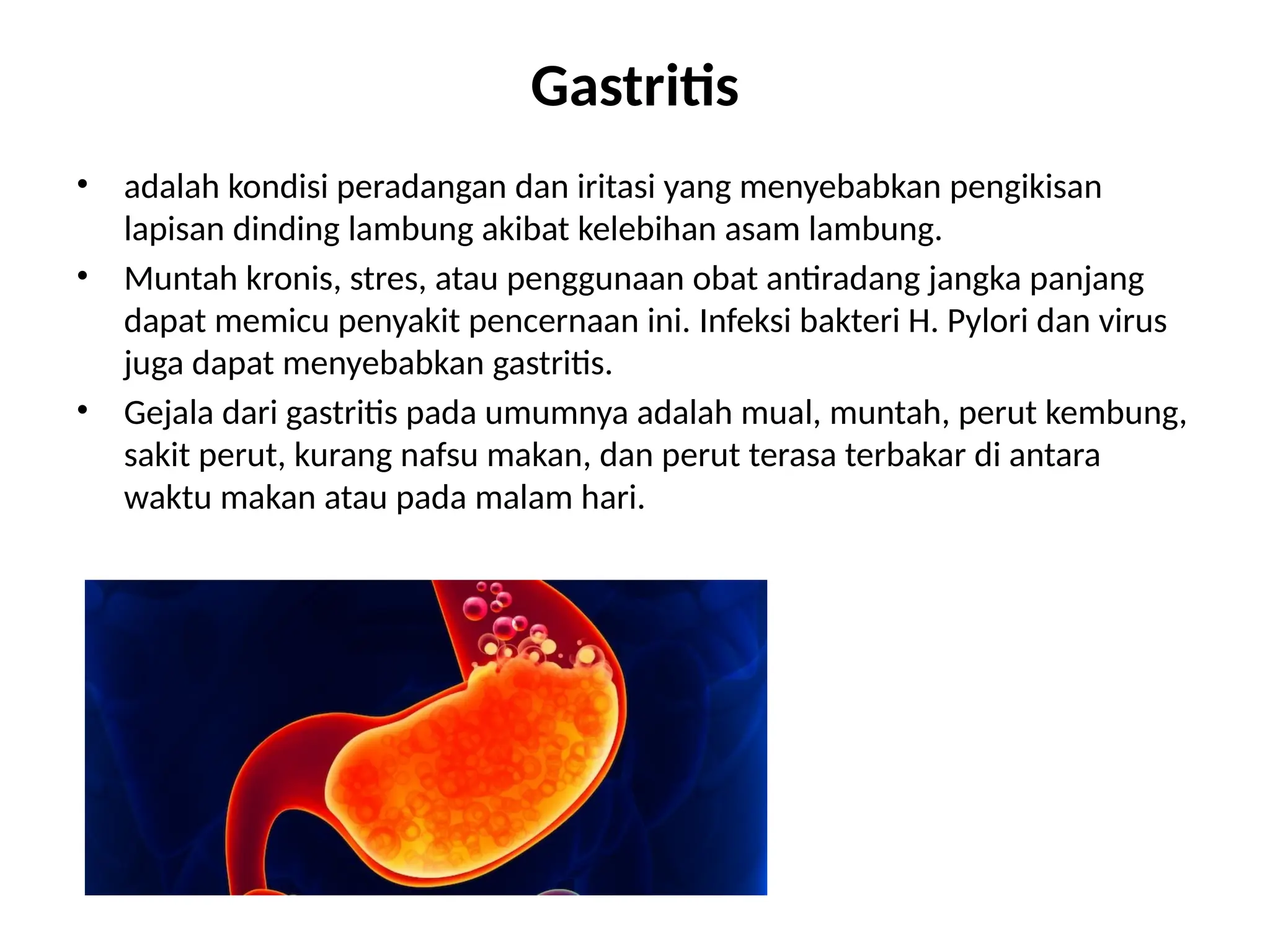 Gangguan pada sistem pencernaan pada manusia.pptx