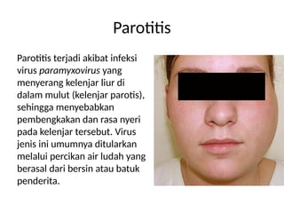 Gangguan pada sistem pencernaan pada manusia.pptx