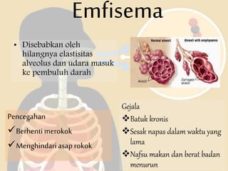 Gangguan pada Sistem Pernapasan | PPTX