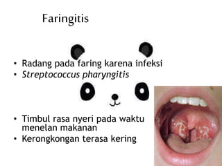 Gangguan pada Sistem Pernapasan | PPTX