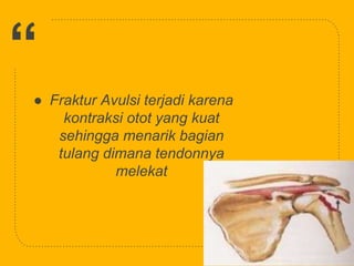 Gangguan pada tulang | PPTX