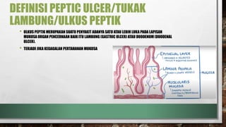 GANGGUAN PENCERNAAN.pptx