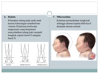 Gangguan sistem gerak | PPTX