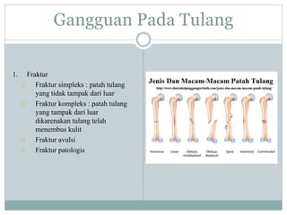 Gangguan sistem gerak | PPTX