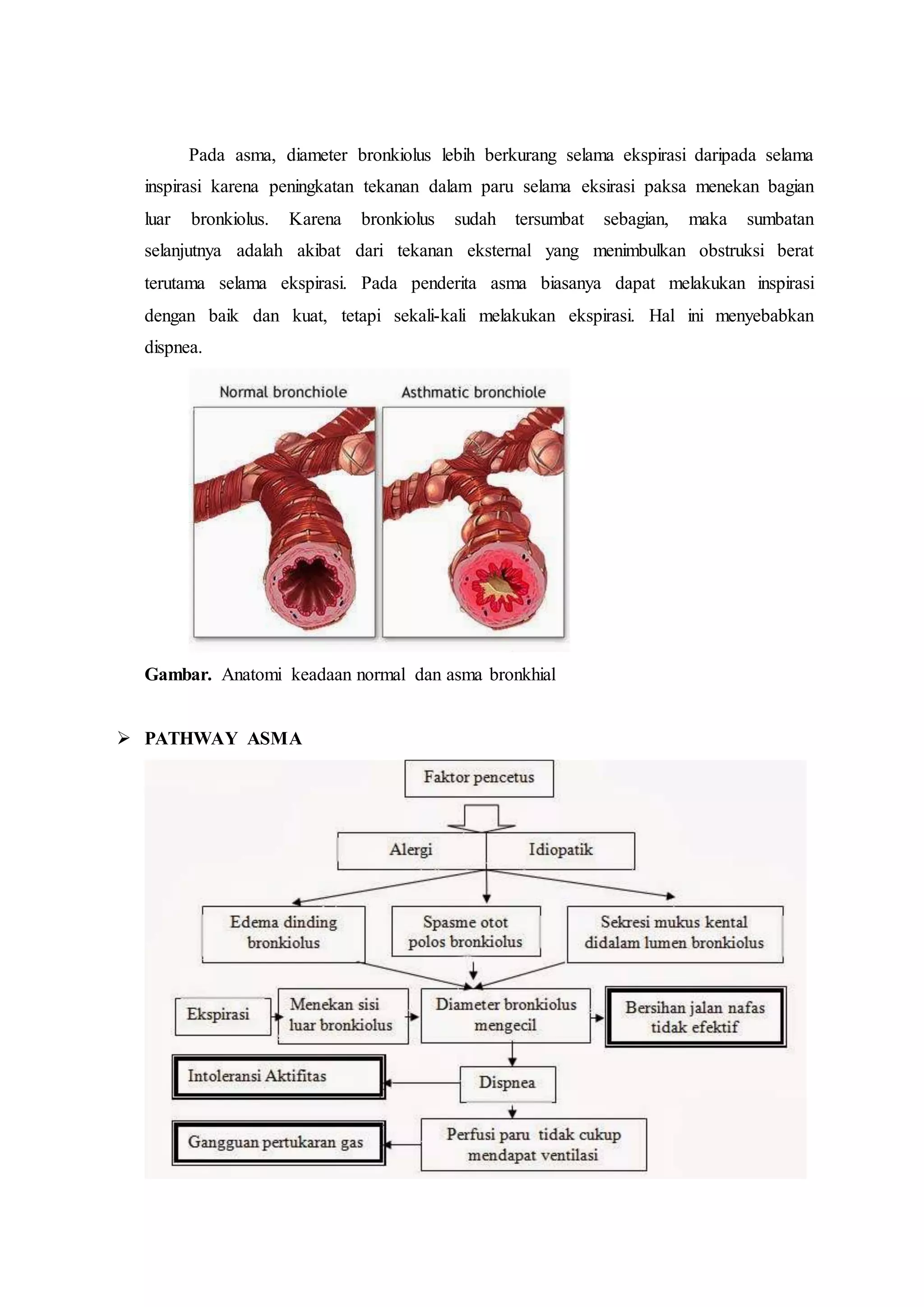 Gangguan sistem pernapasan manusia (asma) | DOCX