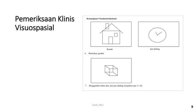 Gangguan visuospasial vit | PPT