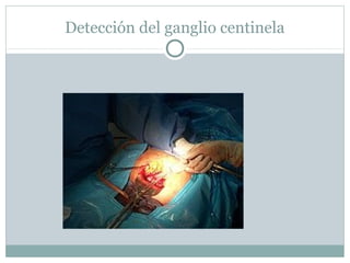 Ganglio centinela en cacu | PPT