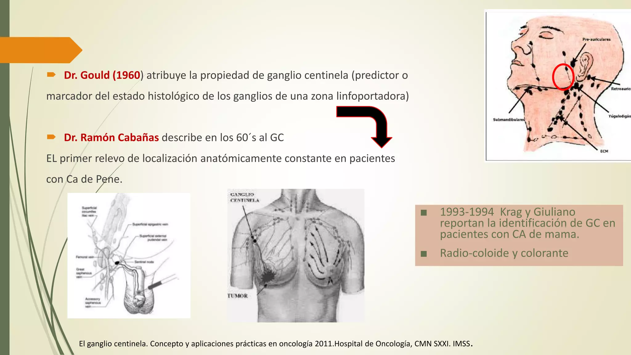 ganglio centinela ORIGINAL.pptx