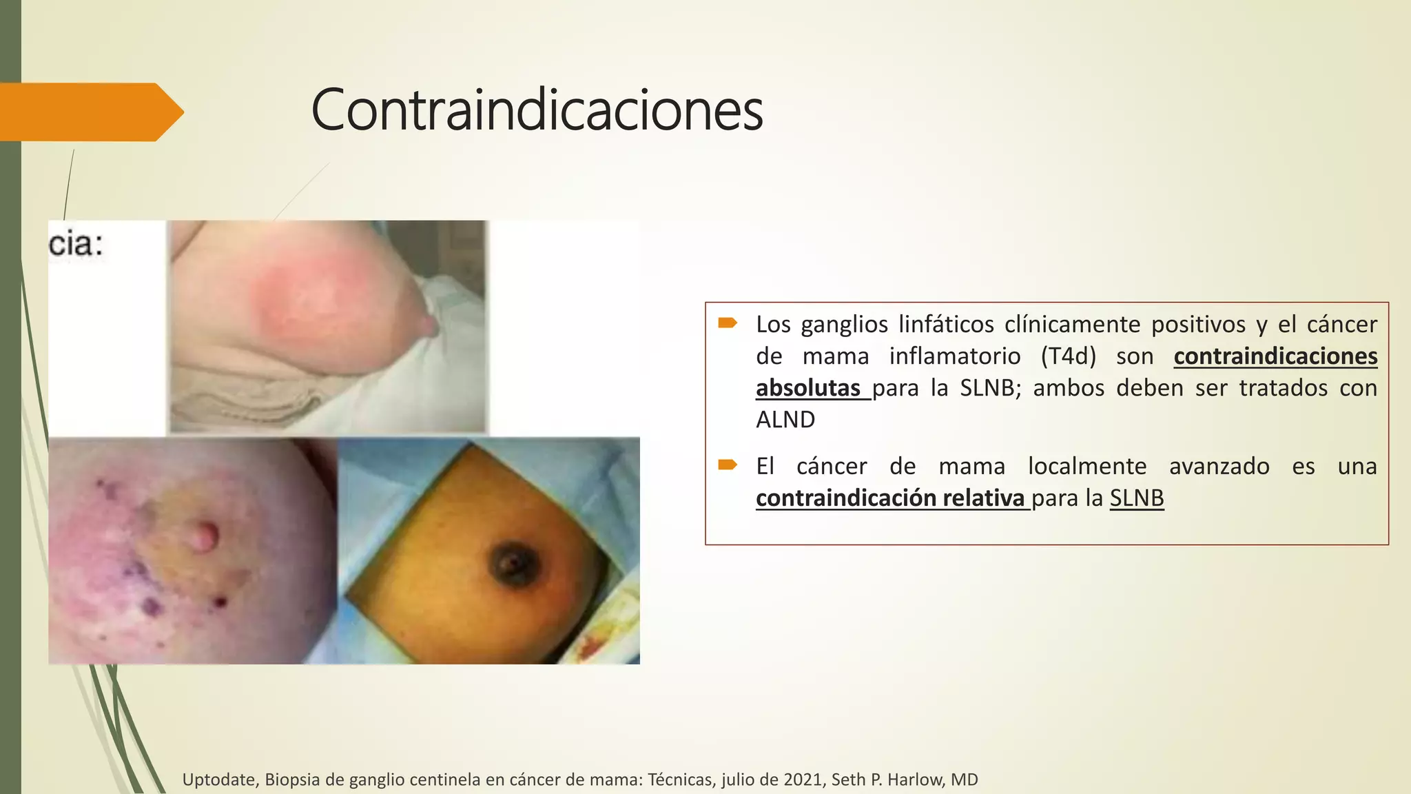 ganglio centinela ORIGINAL.pptx