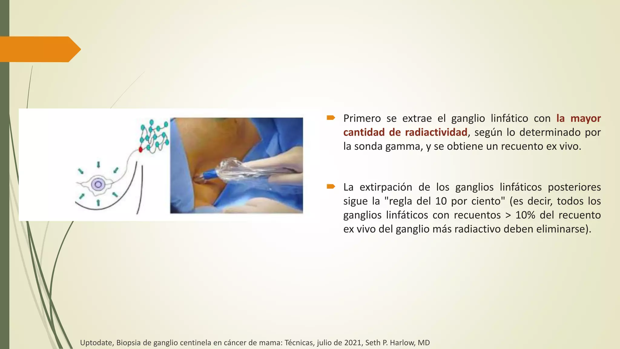 ganglio centinela ORIGINAL.pptx