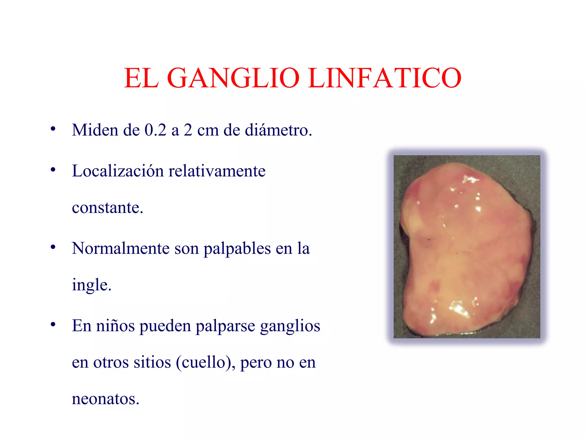 Ganglio linfatico final | PPT