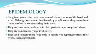 ganglion cyst.pptx