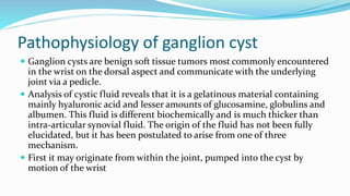 ganglion cyst.pptx