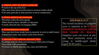 Ganglion cyst -The Silent Swell : Unveiling the Mystery of the Ganglion ...