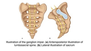 Ganglion Impar Block- Dr Minhaj Akhter ppt.pdf