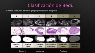 Ganglios Anatomia Imagenología Diagnóstica Pptx