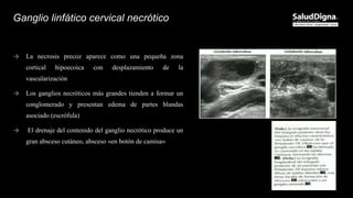 Ganglios cervicales_sindy.pptx