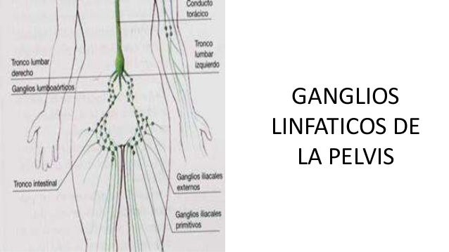 Ganglios linfaticos