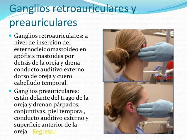 Ganglios linfáticos