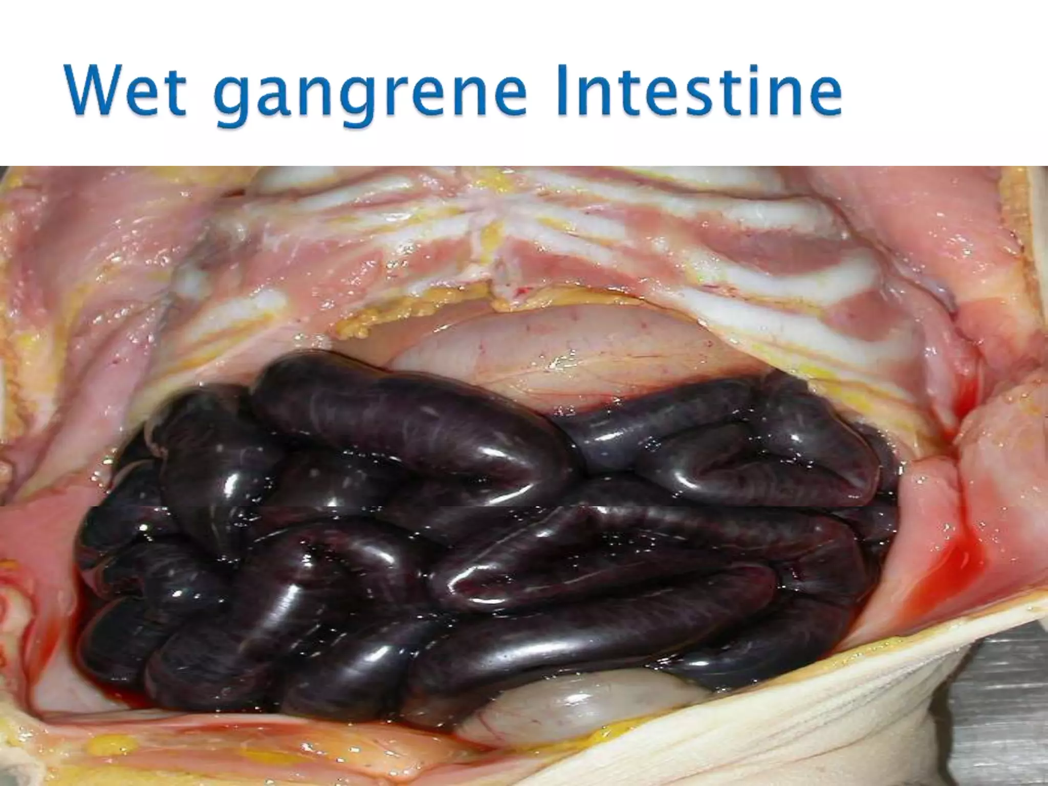 Gangrene | PPTX
