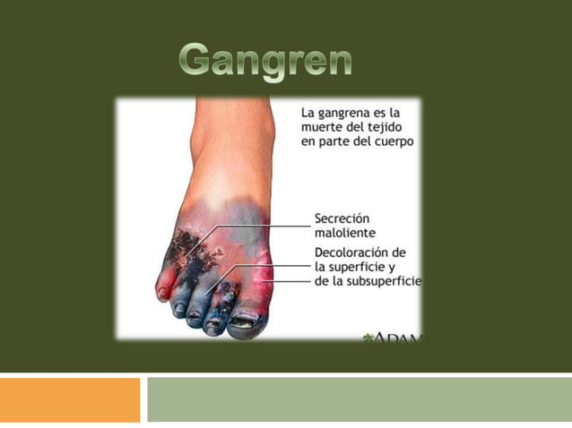 Gangrena de fournier | PPTX