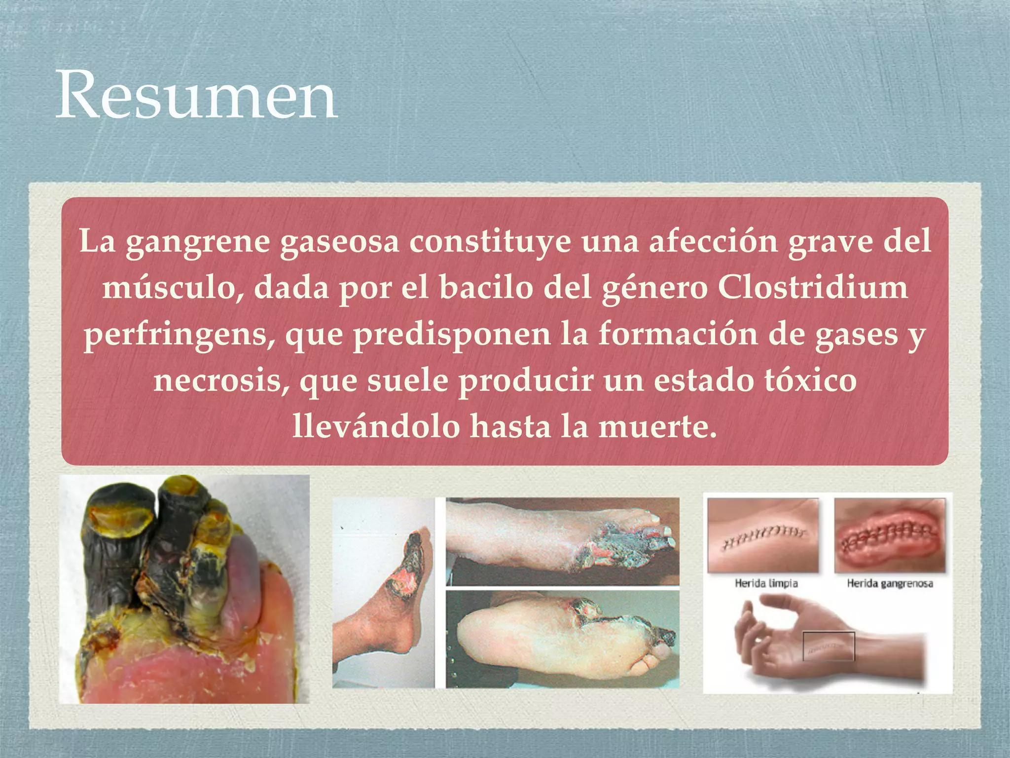 Gangrena gaseosa | PPT