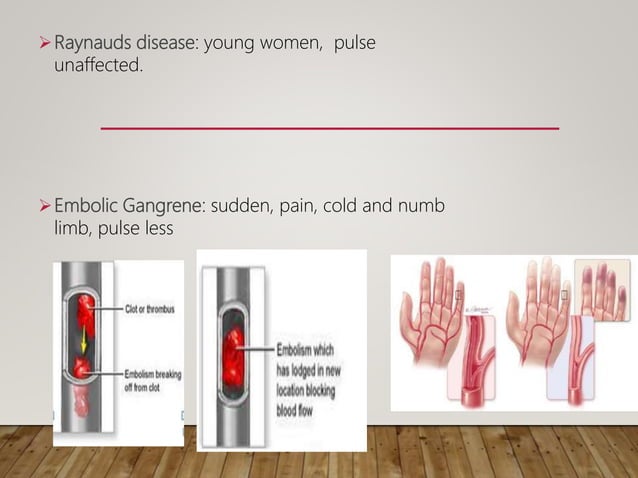 Gangrene | PPTX | Blood Disorders | Diseases and Conditions