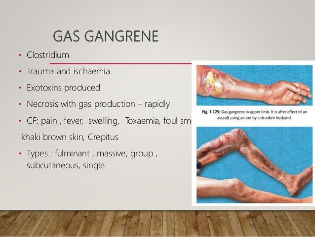 Gangrene