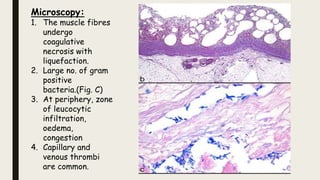 CELL INJURY-II Gangrene | PPTX